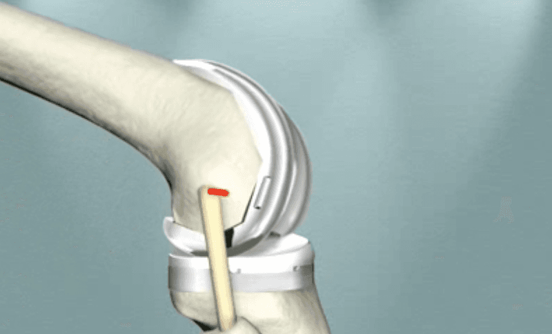 St. George Coral Desert Orthopaedics | Revere Health